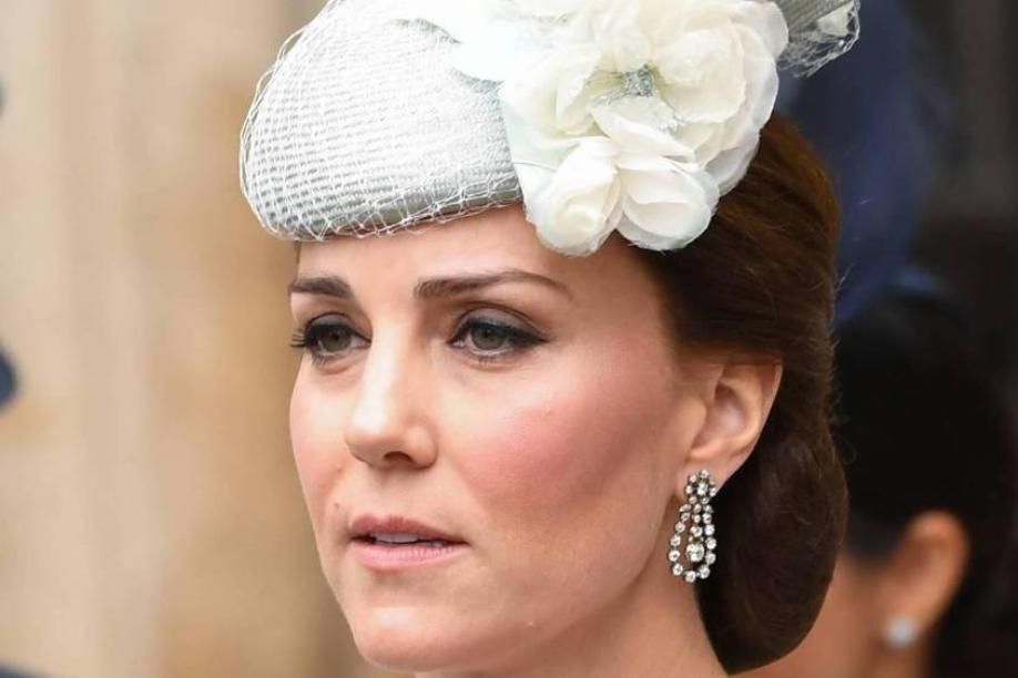 Herzogin Kate: Woher stammt die Narbe an ihrem Kopf? - freenet.de